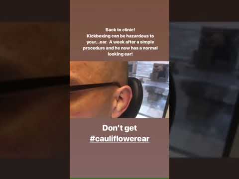 Ear Hematoma