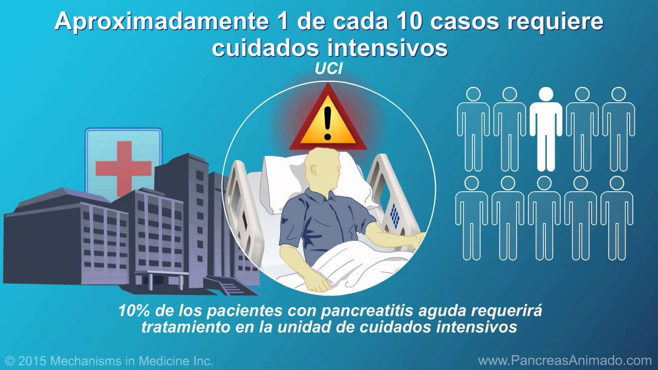 Management and treatment of acute pancreatitis
