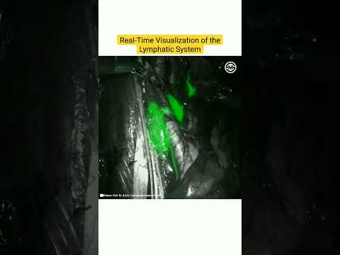 Real-Time Visualization of the Lymphatic System #medical #shorts #tech
