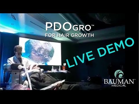 PRP+PDO PDOgro Hair Growth Demo DrAlanBauman