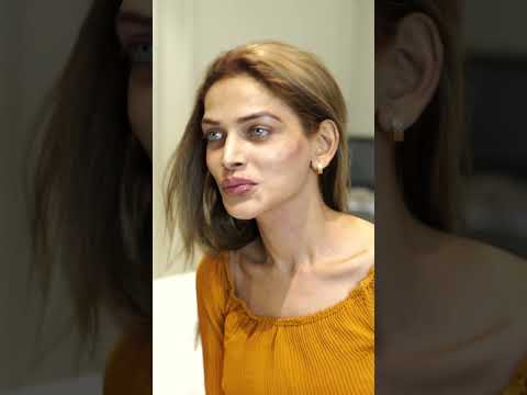 Botox treatment by Dr. Adarsh Tripathi