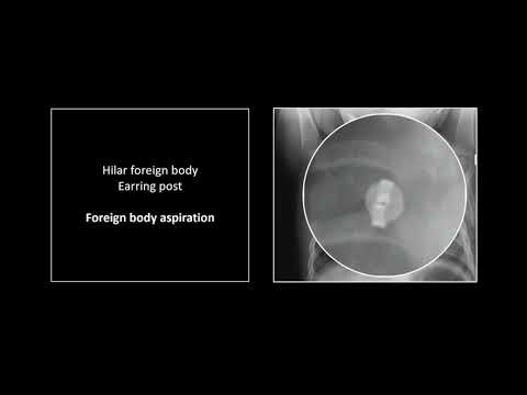 Emergency Pediatric Radiographs | 15 Minute Radiology CME