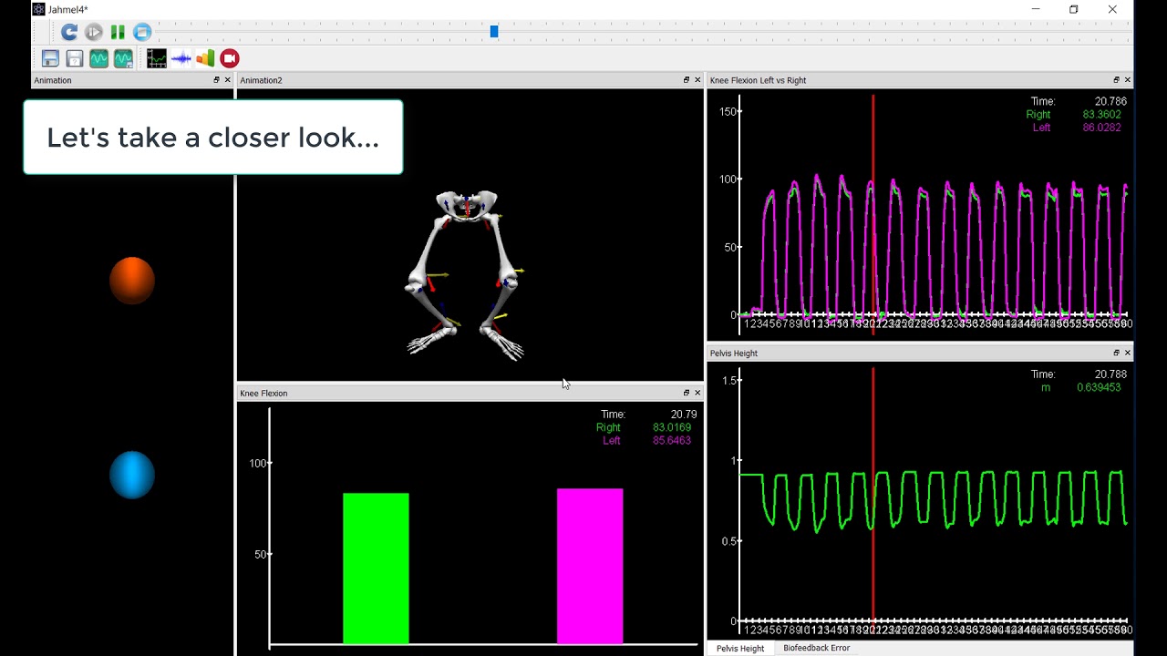 The MotionMonitor xGen Real-Time Biofeedback