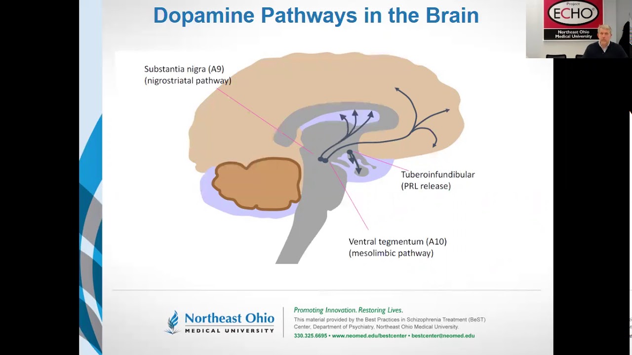 What is Dopamine Psychosis