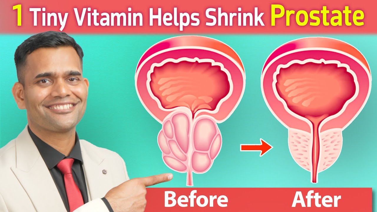 The Power of Vitamin D3 and Exercises for Prostate Health | Galaxy.ai