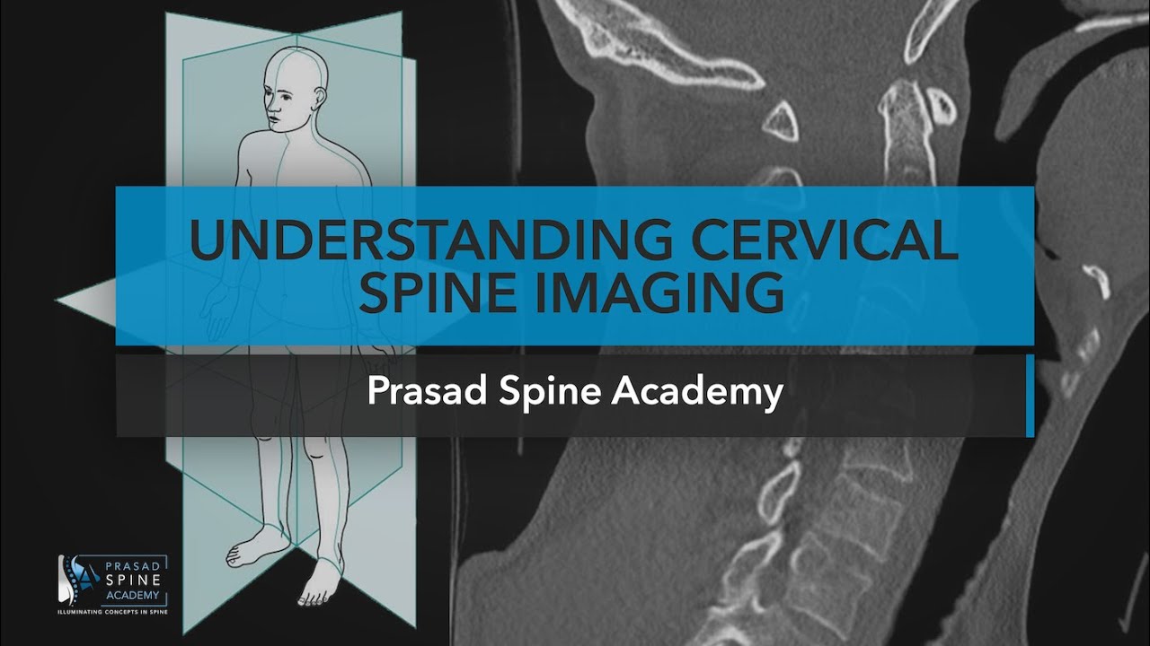 Understanding Cervical Spine Imaging [Chapter 2 FULL]