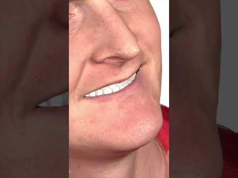 3D printed dentures change everything !