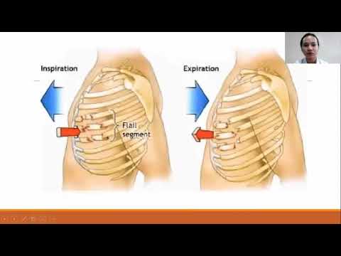 Trauma of the Chest and Lungs: Rib fracture, Flail Chest and Pulmonary Contusion