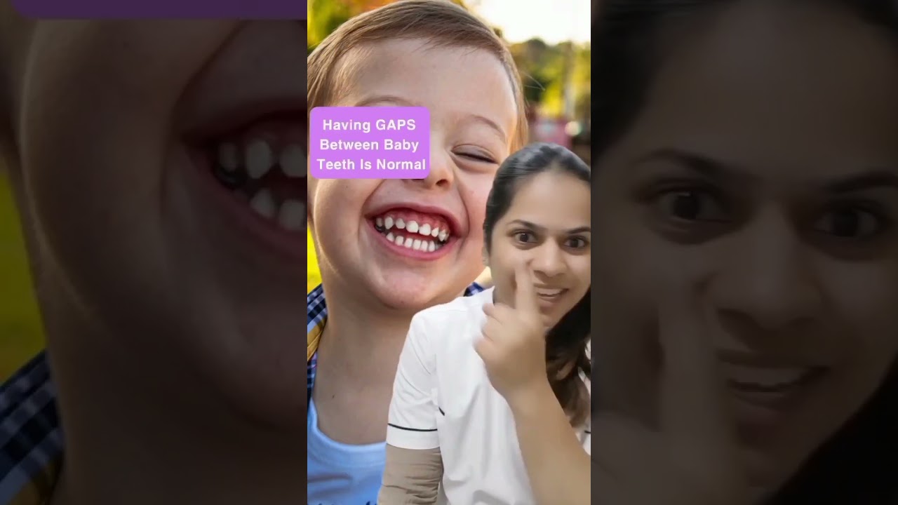 Most parents get anxious when they start noticing gaps between their kid’s baby teeth.