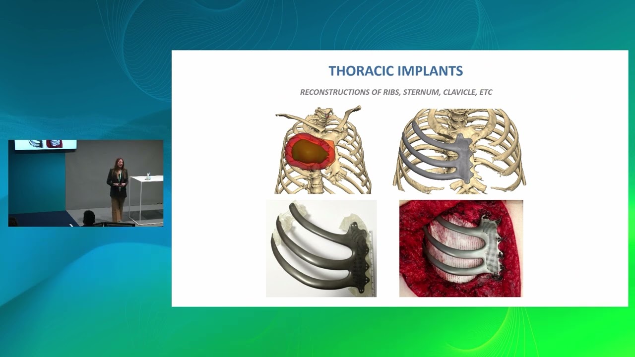 Formnext Expert Insight - Development & clinical application of 3D printed patient specific implants