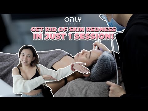 Get rid of skin redness in just 1 session! | OnlyRosacea | Only Aesthetics
