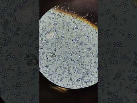 yeast under microscope