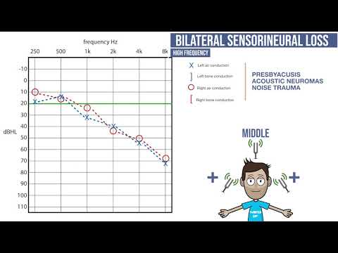 Audiograms