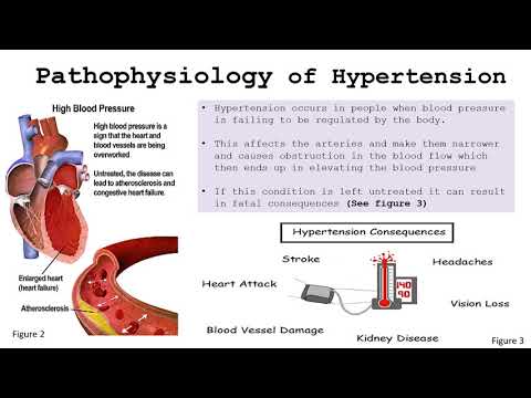 hypertension ppt
