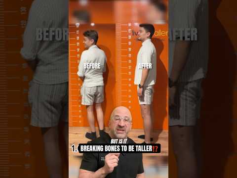 Breaking Bones To Be 3” Taller⁉️ Reality of Limb Lengthening Surgery #shorts