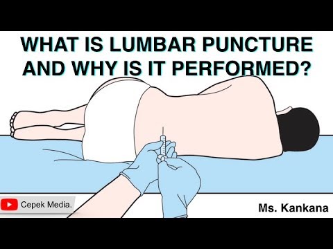 What is Lumbar Puncture and Why is it done | Biotechnology | General Medicin