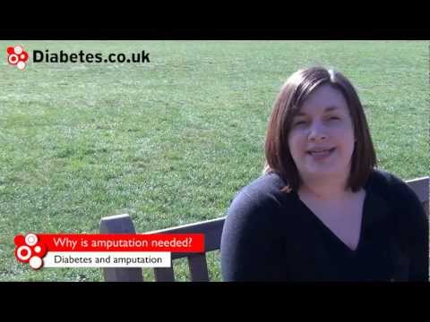 Diabetes and Amputation - Preventing Amputations