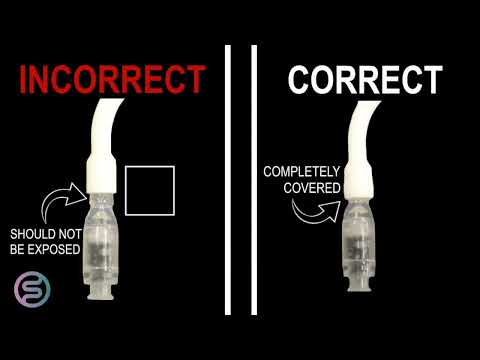 La Importancia del Sistema Valve- Hold