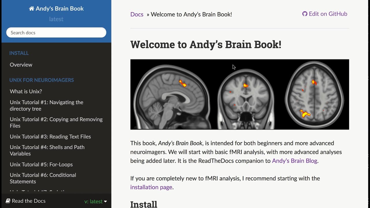 Introducing Andy's Brain Book
