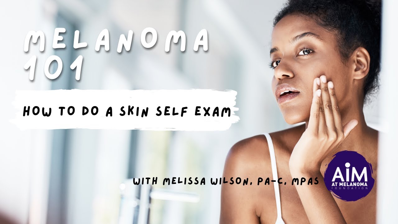 How to Do a Skin Self Exam