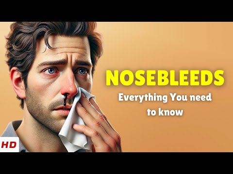 Nosebleeds Explained: Causes, Types, Signs and Symptoms & How To Stop Them FAST!
