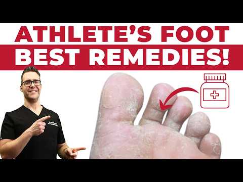 Severe Athlete's Foot on Foot & Heel: [Causes & Best Treatment]