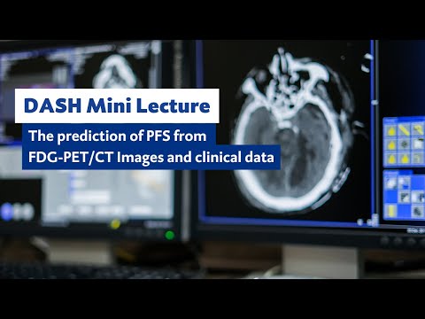 DASH Mini Lecture: The prediction of PFS from FDG-PET/CT Images and clinical data