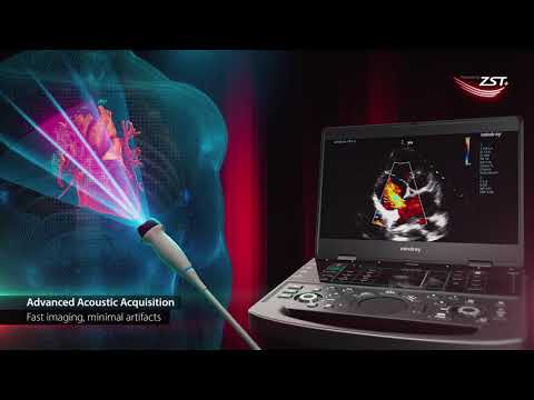 Mindray ME7 Portable Ultrasound
