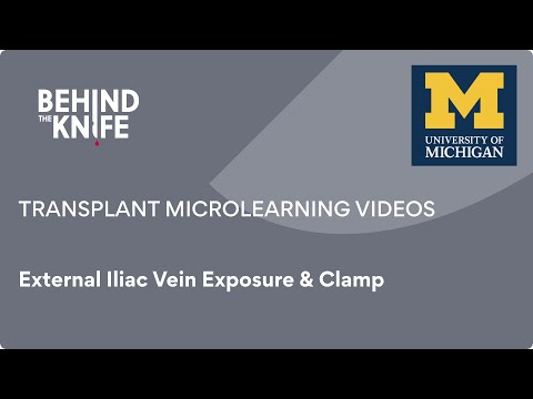 External Iliac Vein Exposure & Clamp