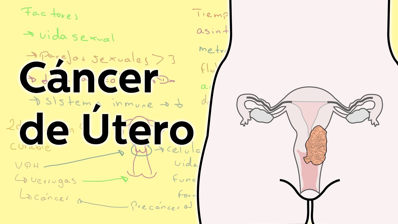 Conicet. Avanza el desarrollo de un kit rápido de diagnóstico para prevenir el cáncer de cuello ...