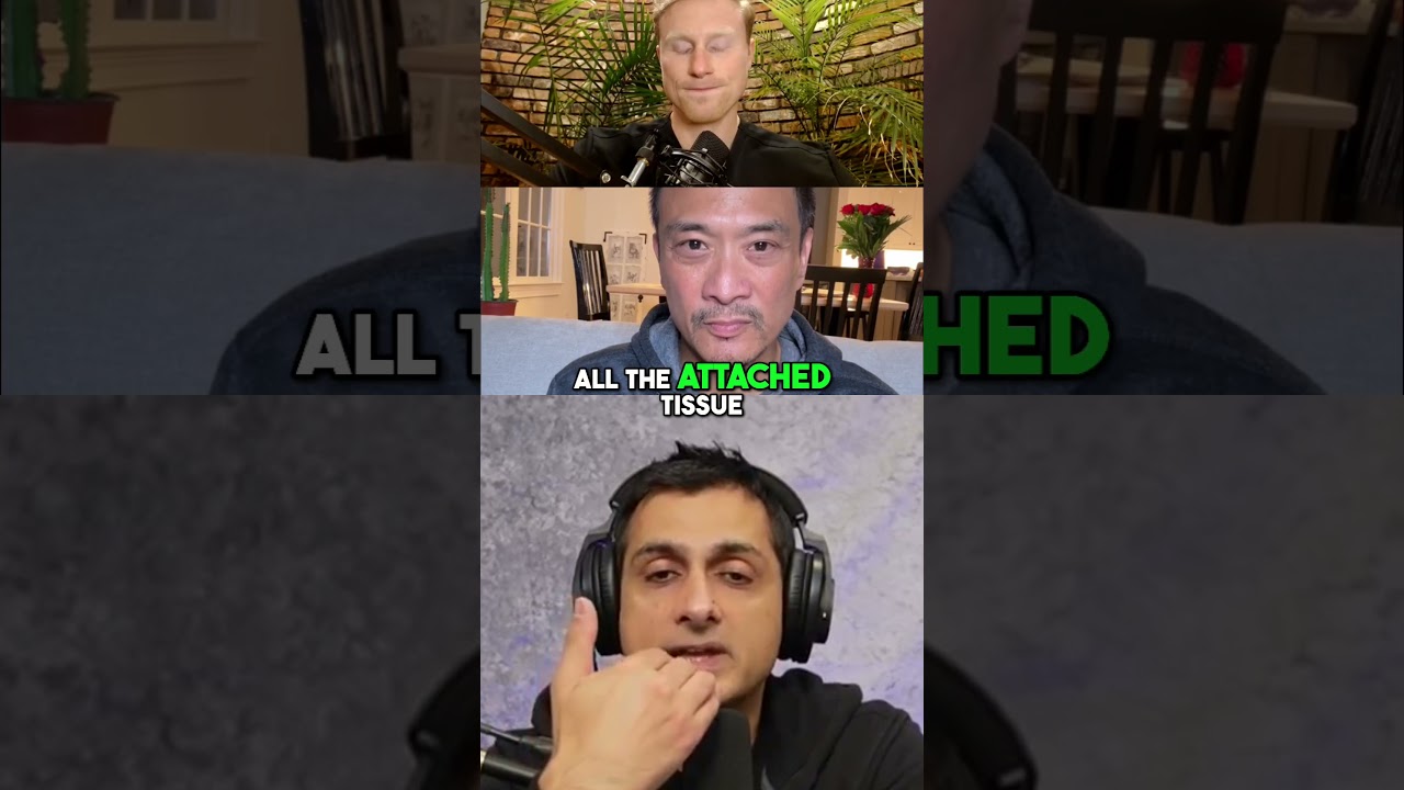 Laser Frenectomy Gone Wrong: Avoid This Dental Mistake! x From Dose of Dental Podcast #182