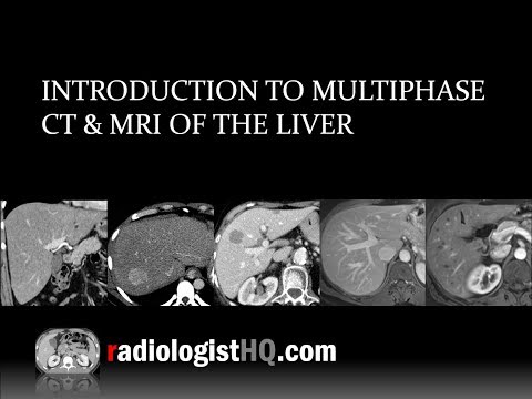 Introduction to Multiphase CT & MRI of the Liver