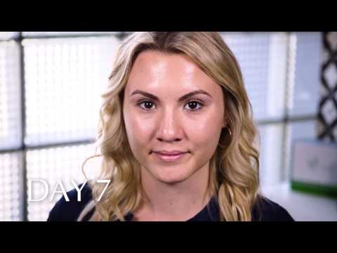 The Beauty of Peeling | V Boutique | Dr. V - Neda Vanden Bosch MSPB