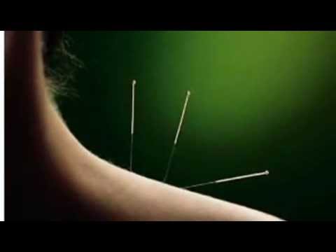 What does Acupuncture Cure? www.evolvewellness.com
