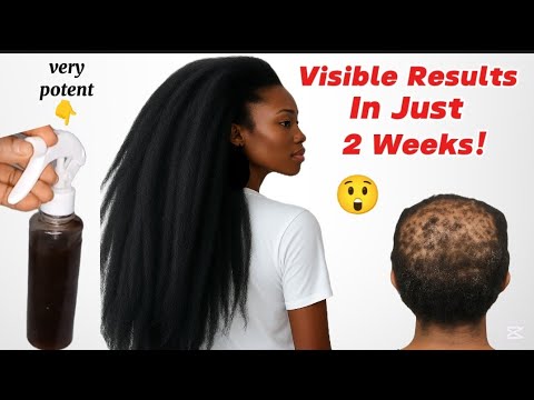 Hair Grows Insanely Fast! Achieve THICK FULL & LONG HAIR!