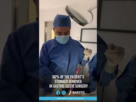 Gastric Sleeve Surgery