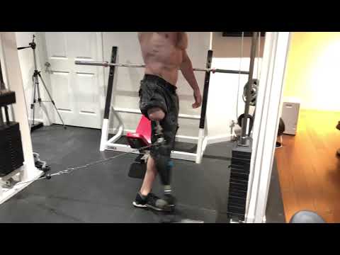 9 months post op – The Bionic Civilian