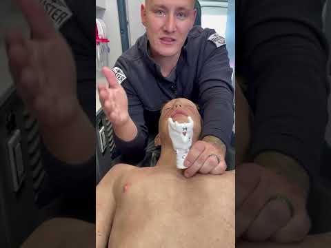 Landmarking for a Cricothyrotomy
