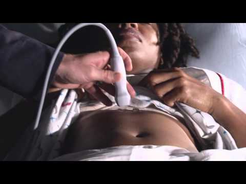 Teaching Bedside Ultrasound of Fluid Status / Inferior Vena Cava (Stanford 25 Skills Symposium)