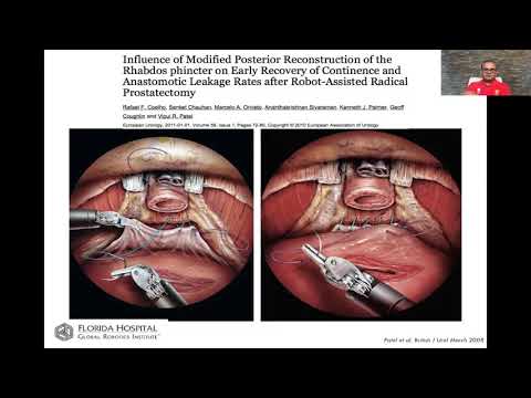 Keynote Presentation: Robotic Radical Prostatectomy: Lessons learned from 14,000 cases