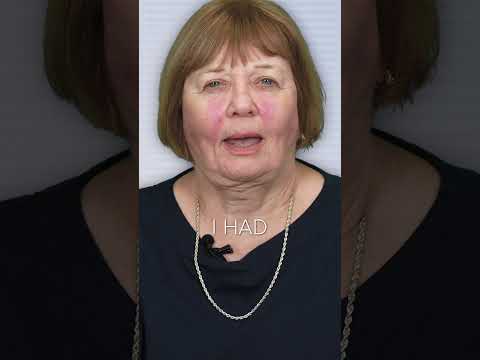 FACELIFT RESULT