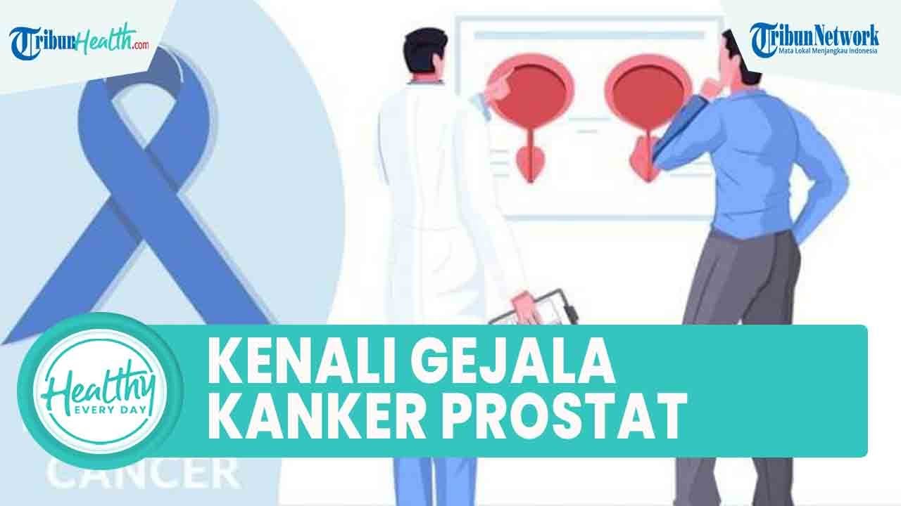 Pria Wajib Tahu! Gejala Kanker Prostat yang Jarang Diketahui: Sulit BAK hingga Disfungsi Ereksi ...