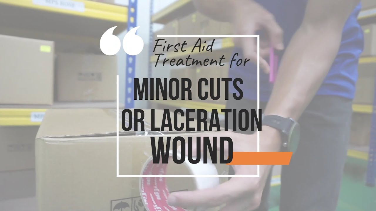 First Aid Treatment for Minor Cuts or Laceration Wound | Star Medik TV
