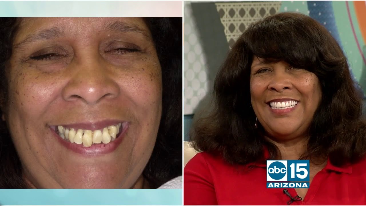 Gasser Dental: Incredible smile transformation
