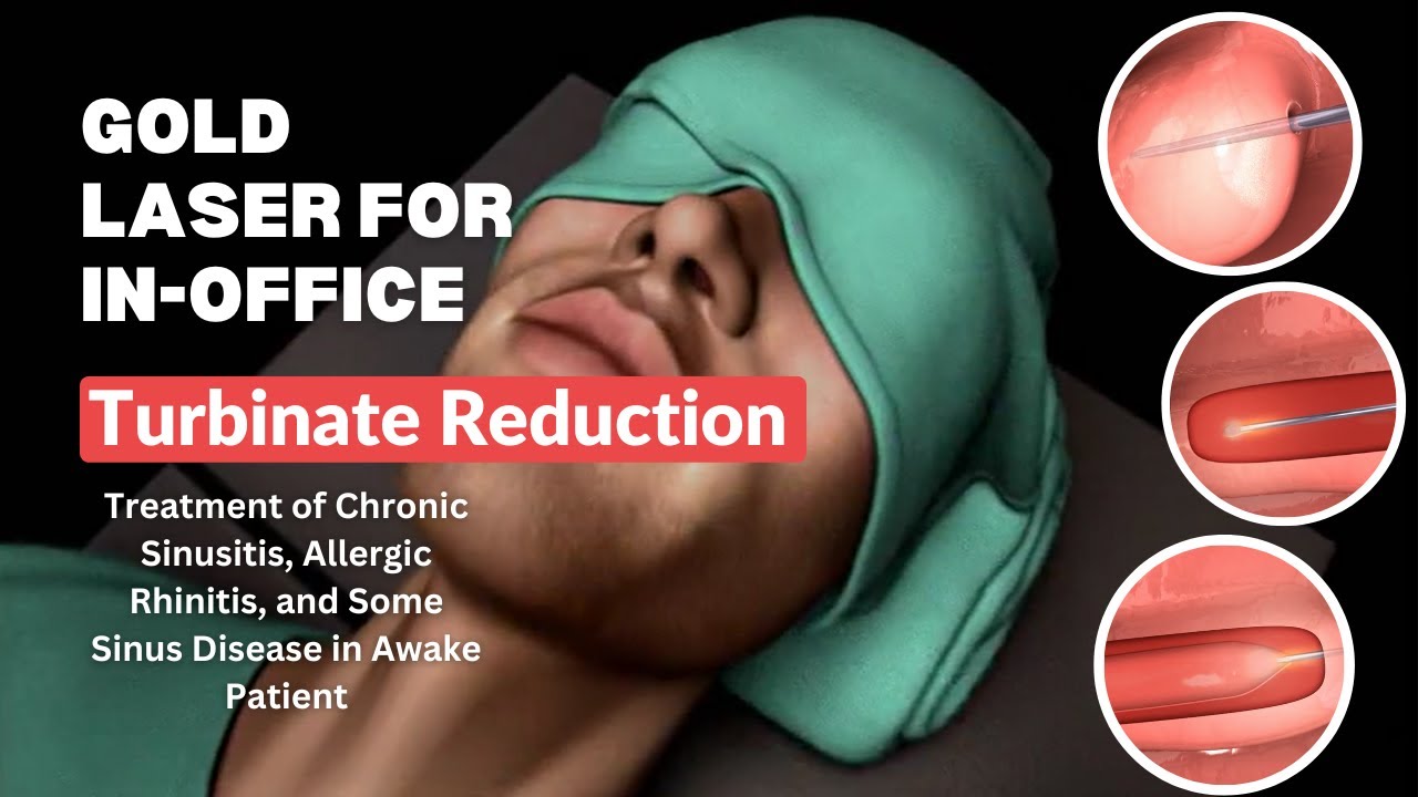 New Gold Laser for In-Office Turbinate Reduction