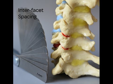 Facet Spacing - Dynamic Disc Designs Corp.