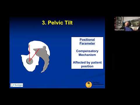 hen Degenerative Becomes Deformity: Robert Eastlack, MD, on February 7, 2022