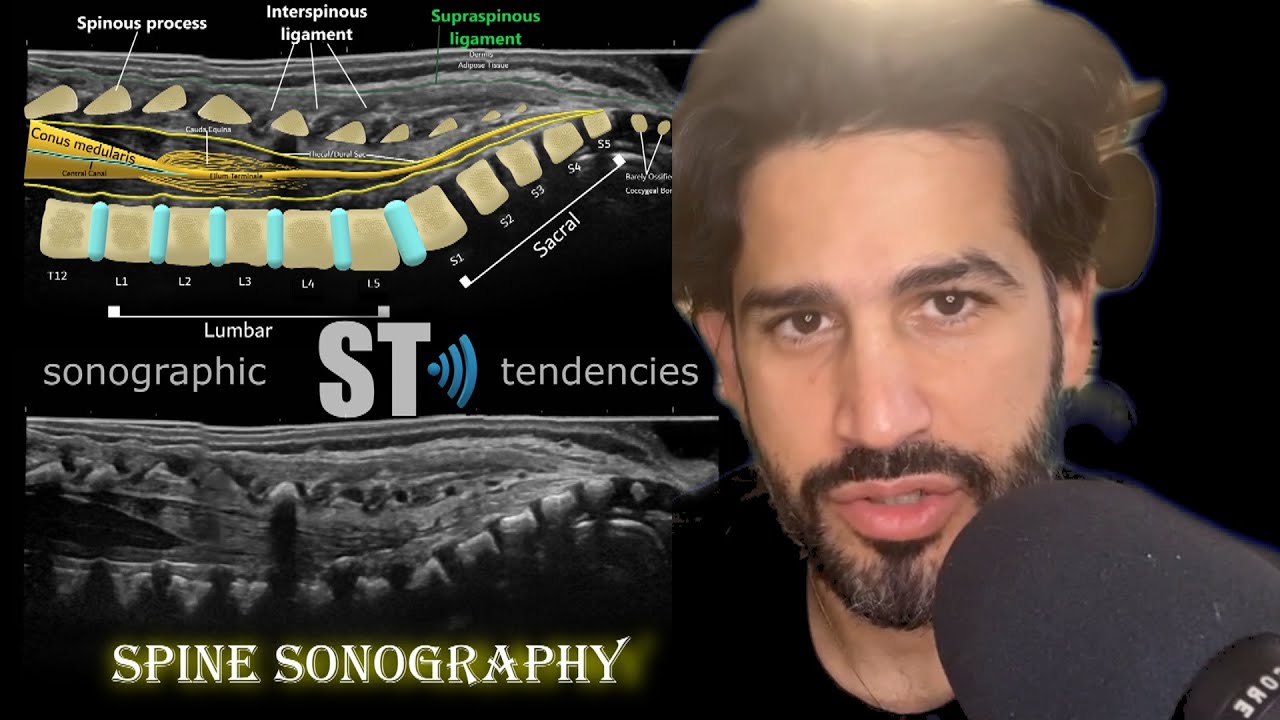 Spine Ultrasound Protocol