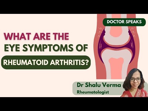 Eye Symptoms Of Rheumatoid Arthritis