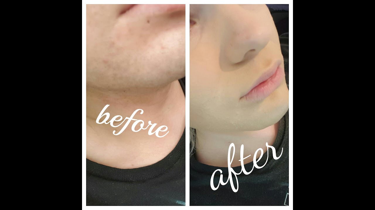 BEARD COVERAGE IN 2 MINUTES!!